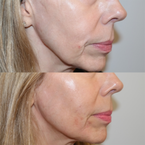 reJAWvenation - Rejuvenation Resource